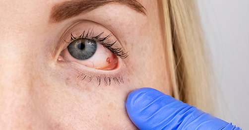 Family Urgent Care | Foreign Body Removal