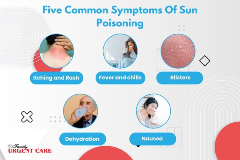 Sun Poisoning: Symptoms, Treatment and Care with Prevention!