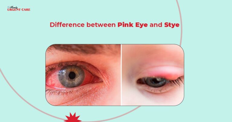 What Are The Key Differences Between Pink Eye and Stye? - Family Urgent ...